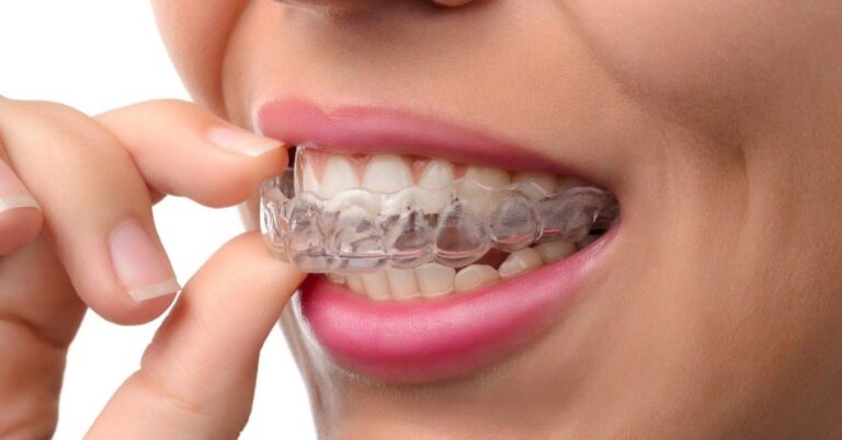 Invisalign Doctor Login: What You Need to Know - MaccaBlog